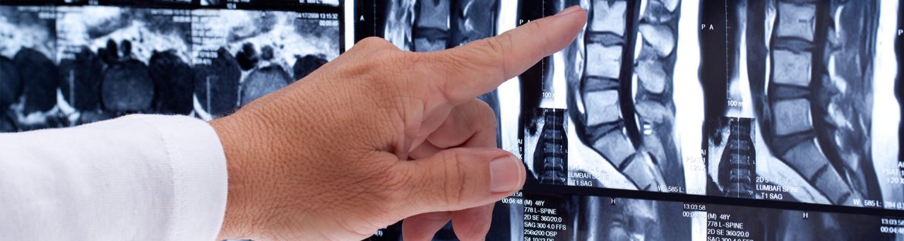 How Spinal Injections Help | Rehabilitation Medicine Center of New York